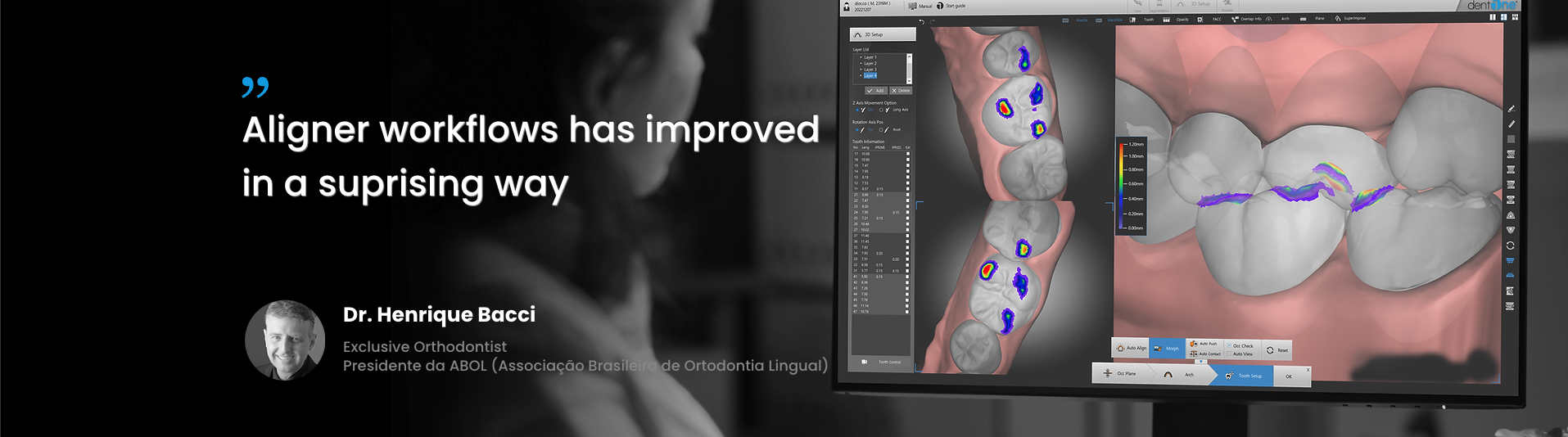 dentOne - dentOne / clear aligner / 3D Orthodontic Software
