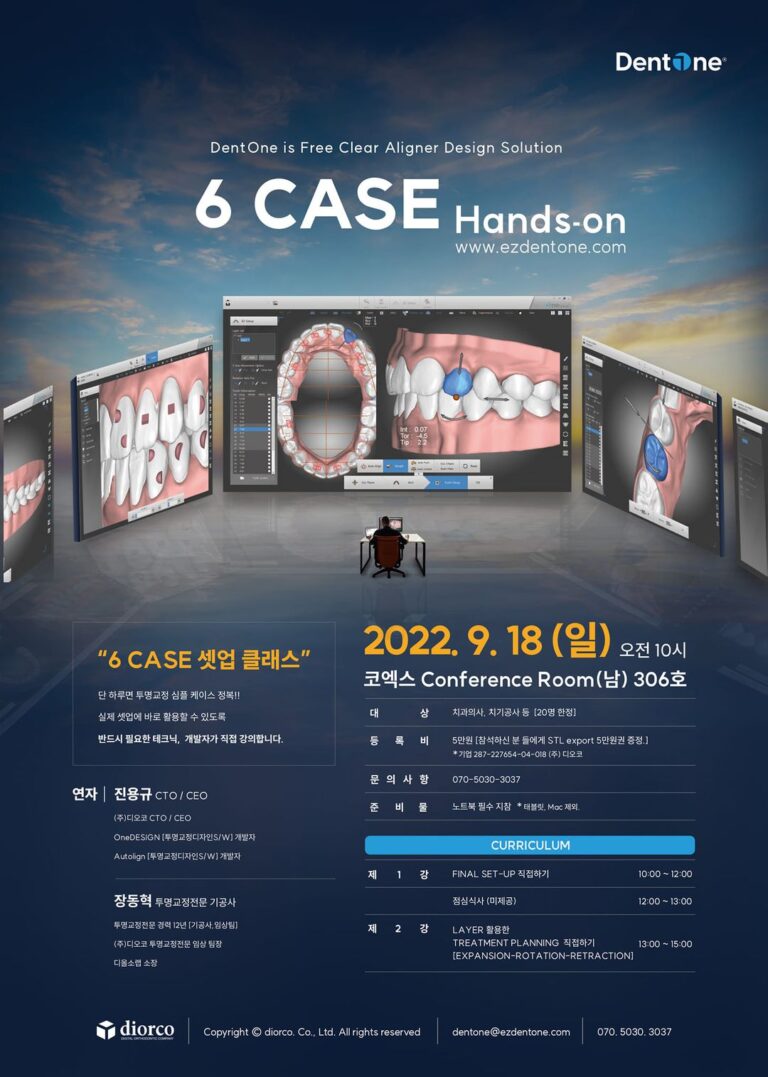 Clear Aligner 6case Hands On Dentone Clearaligner 3d Orthodontic Software