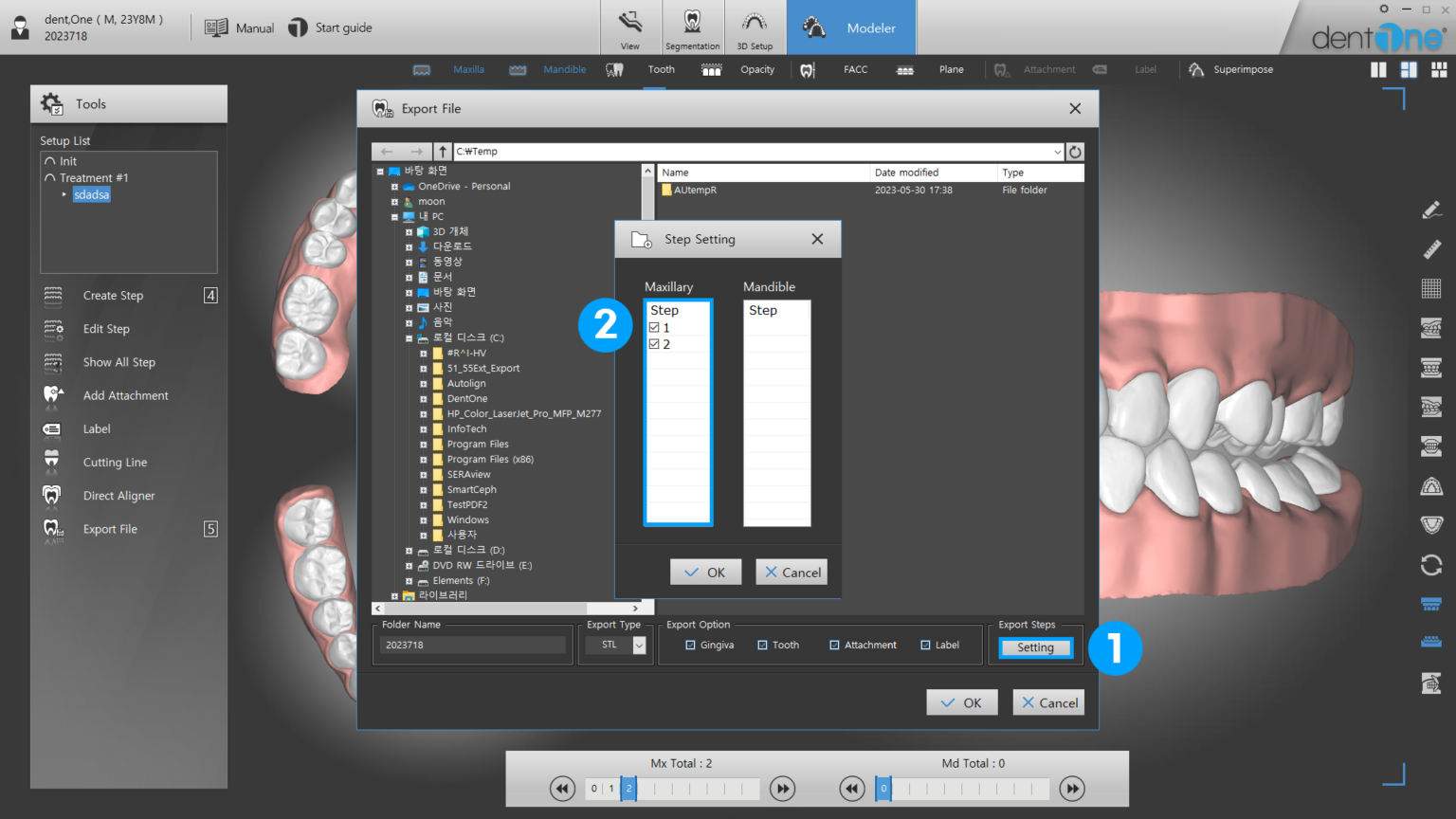 designsoftware-modeler - dentOne / clear aligner / 3D Orthodontic Software
