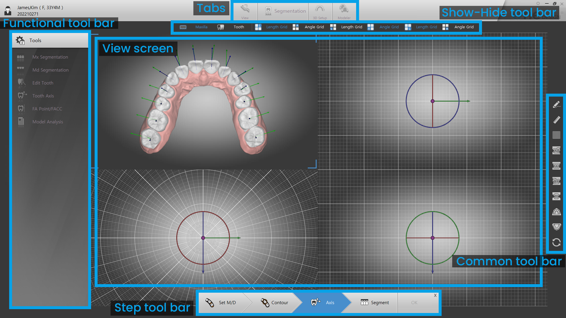 designsoftware-common - dentOne / clear aligner / 3D Orthodontic Software