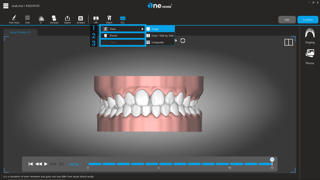 viewer-functiontoolbar - dentOne / clear aligner / 3D Orthodontic Software