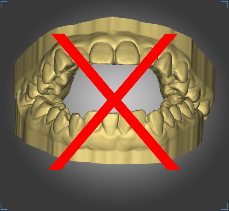 designsoftware-viewer - dentOne / clear aligner / 3D Orthodontic Software