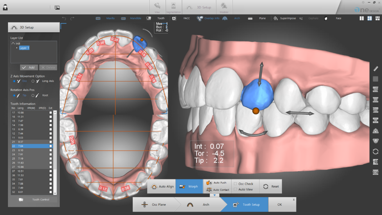 knowhow-design - dentOne / clearaligner / 3D Orthodontic Software
