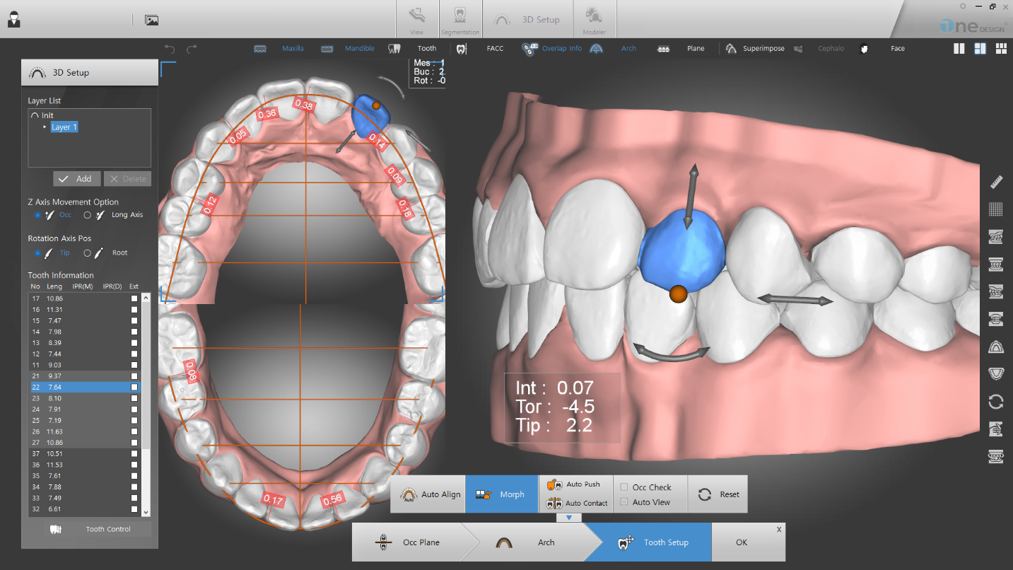 knowhow-design - dentOne / clearaligner / 3D Orthodontic Software