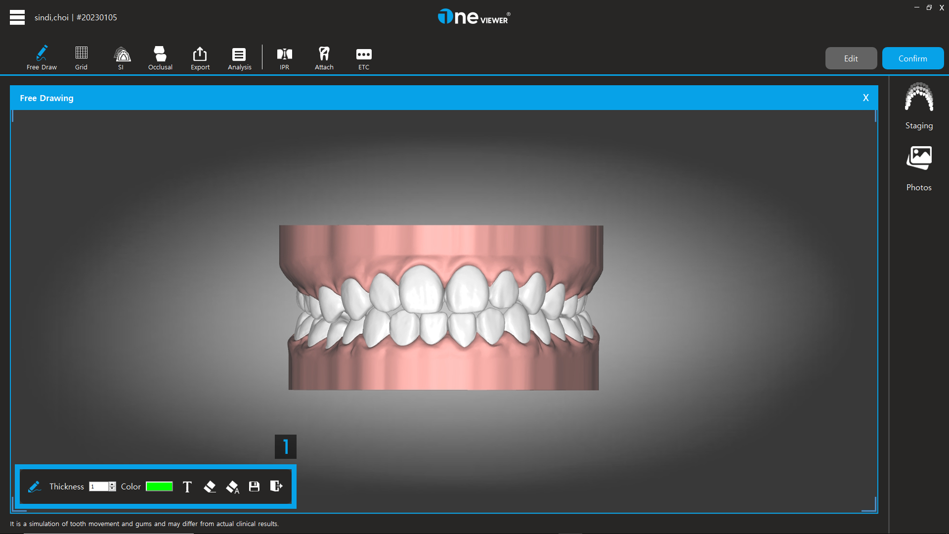 viewer-functiontoolbar - dentOne / clear aligner / 3D Orthodontic Software