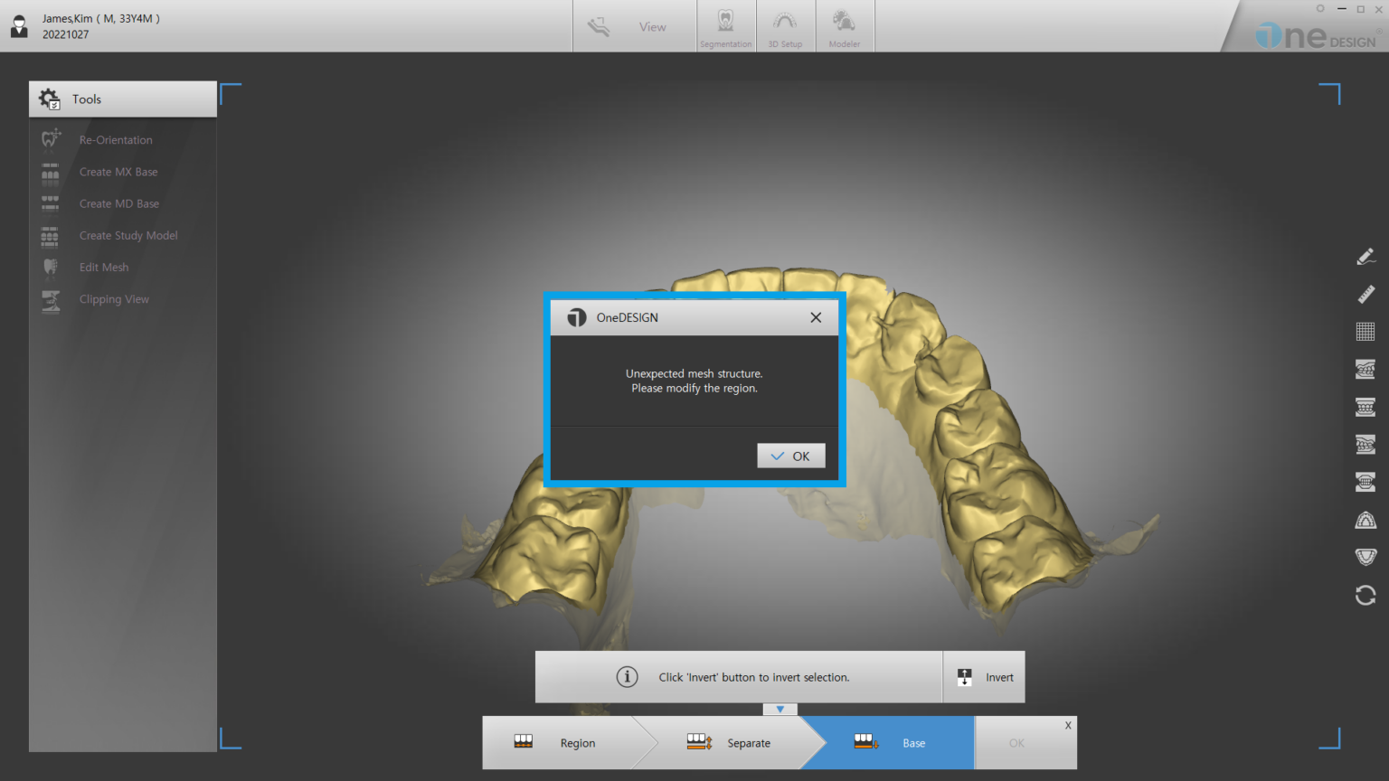 designsoftware-viewer - dentOne / clearaligner / 3D Orthodontic Software