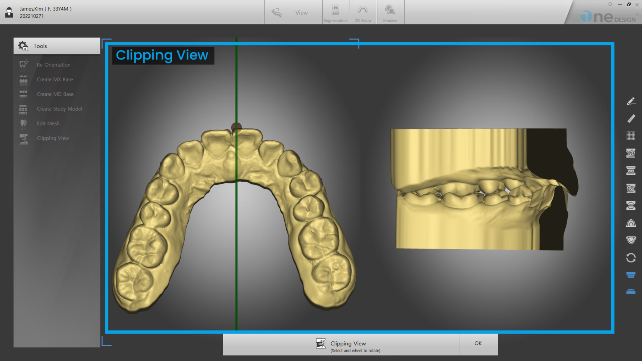 designsoftware-viewer - dentOne / clearaligner / 3D Orthodontic Software