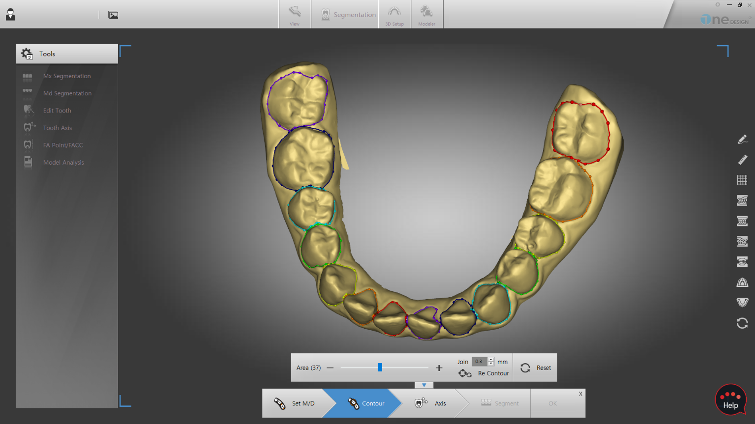 knowhow-design - dentOne / clearaligner / 3D Orthodontic Software