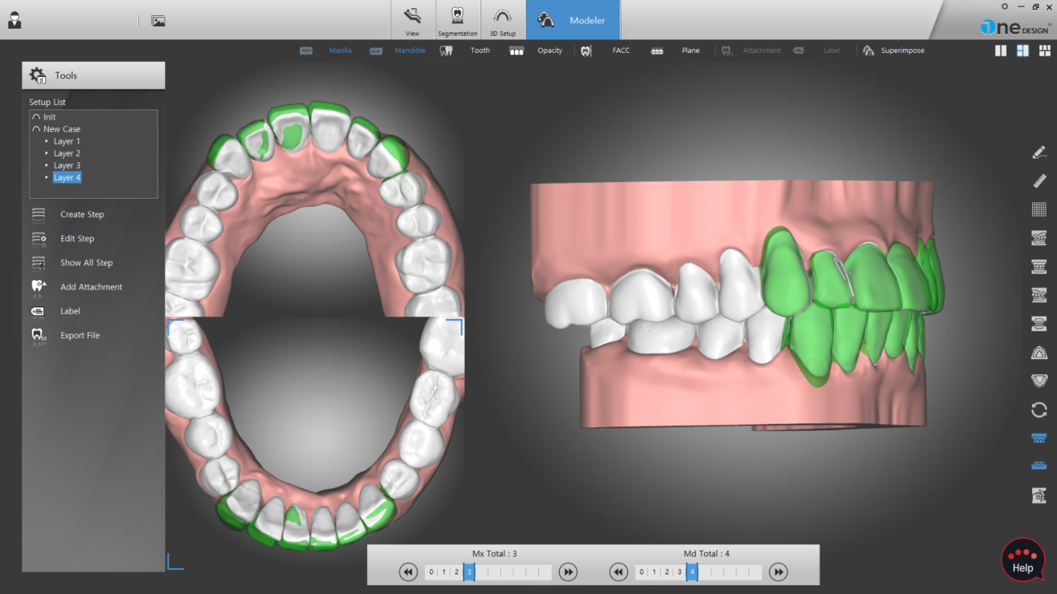 knowhow-design - dentOne / clearaligner / 3D Orthodontic Software
