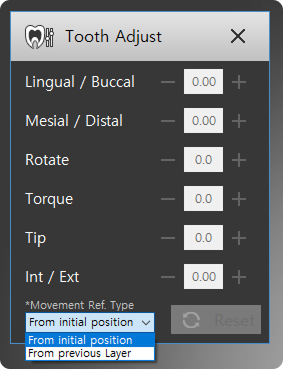 designsoftware-3dsetup - dentOne / clear aligner / 3D Orthodontic Software